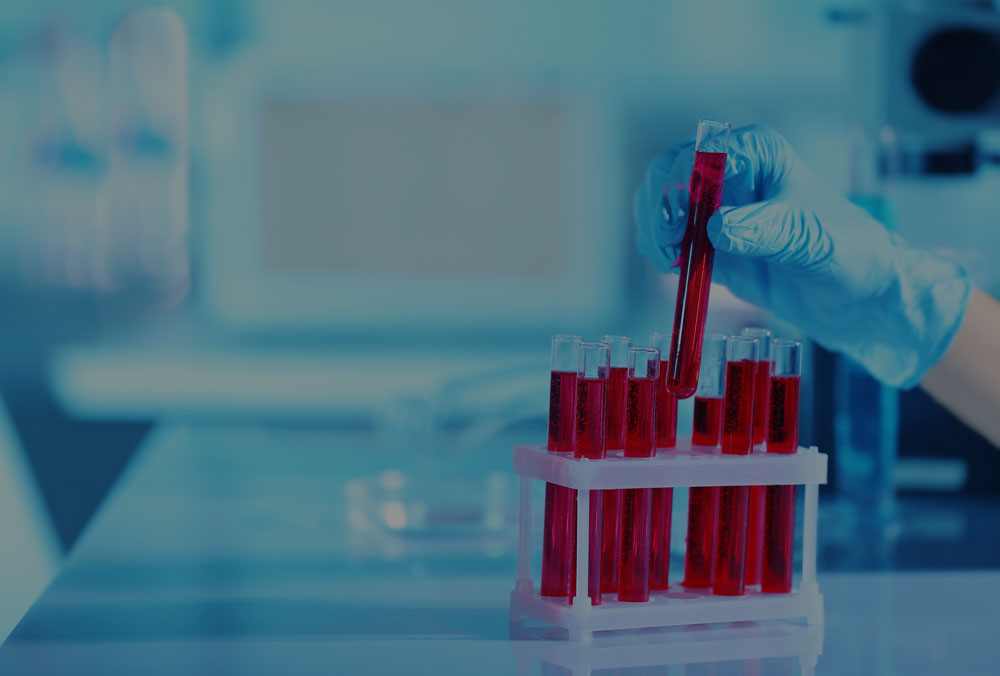 Blood Reagents Antitrust | Macmoor Capital